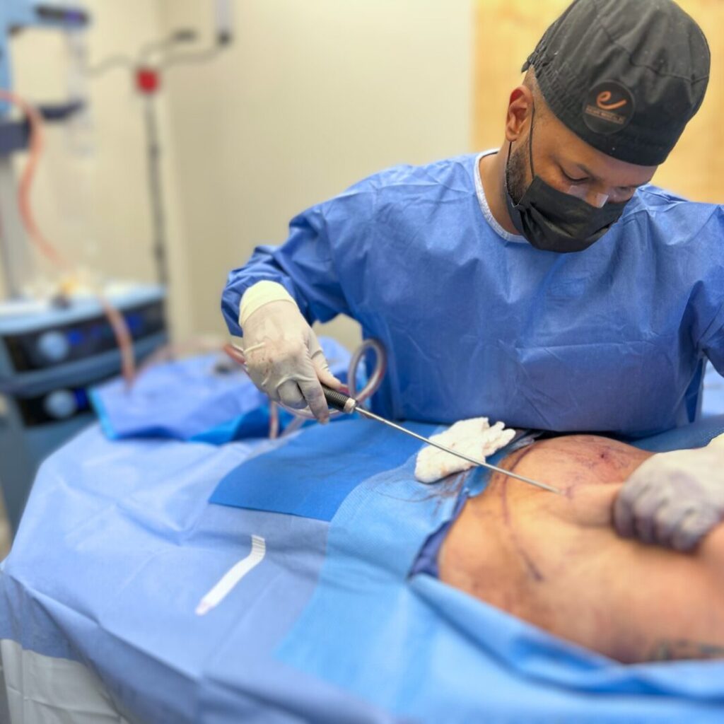 CoolSculpting Vs Liposuction: 9 Expert-Backed Differences Explained ...